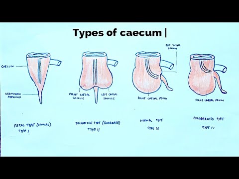 Types of caecum | med tutorials | - YouTube