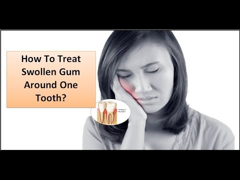 Best Toothpaste For Swollen Gums - Treat Receding Gums Naturally - YouTube