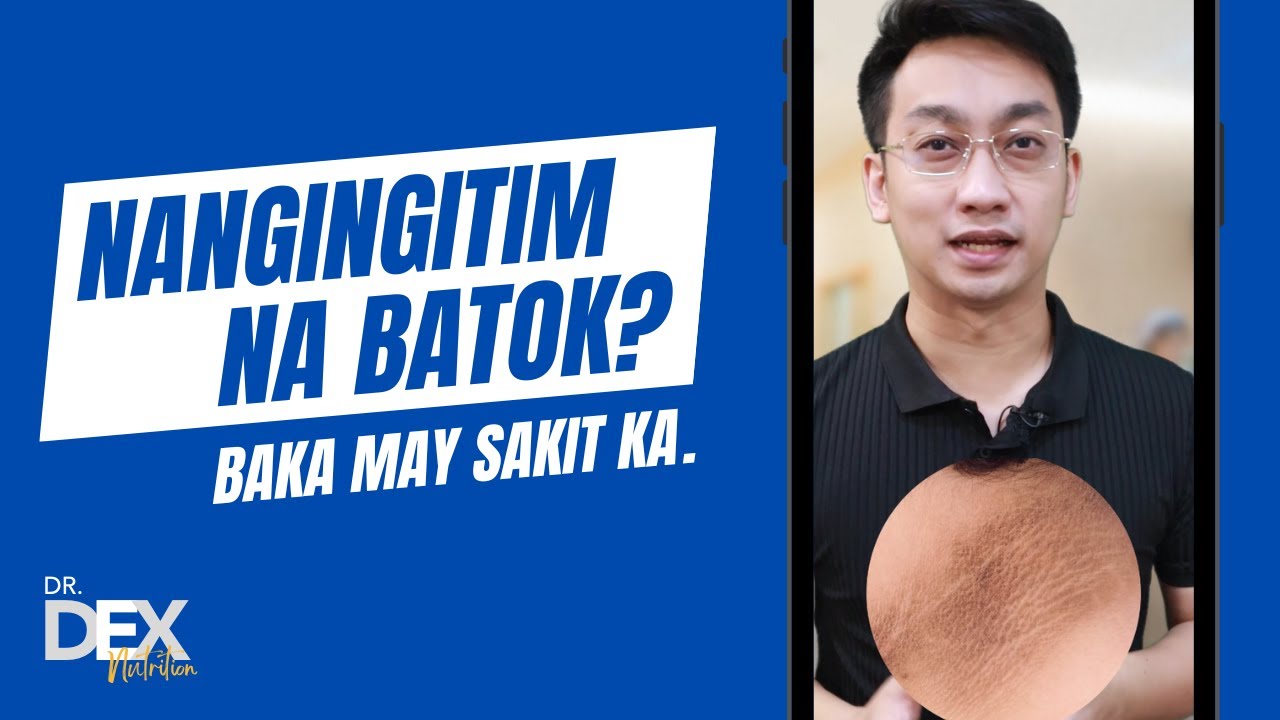 Nangingitim na batok? Baka may sakit ka. - YouTube
