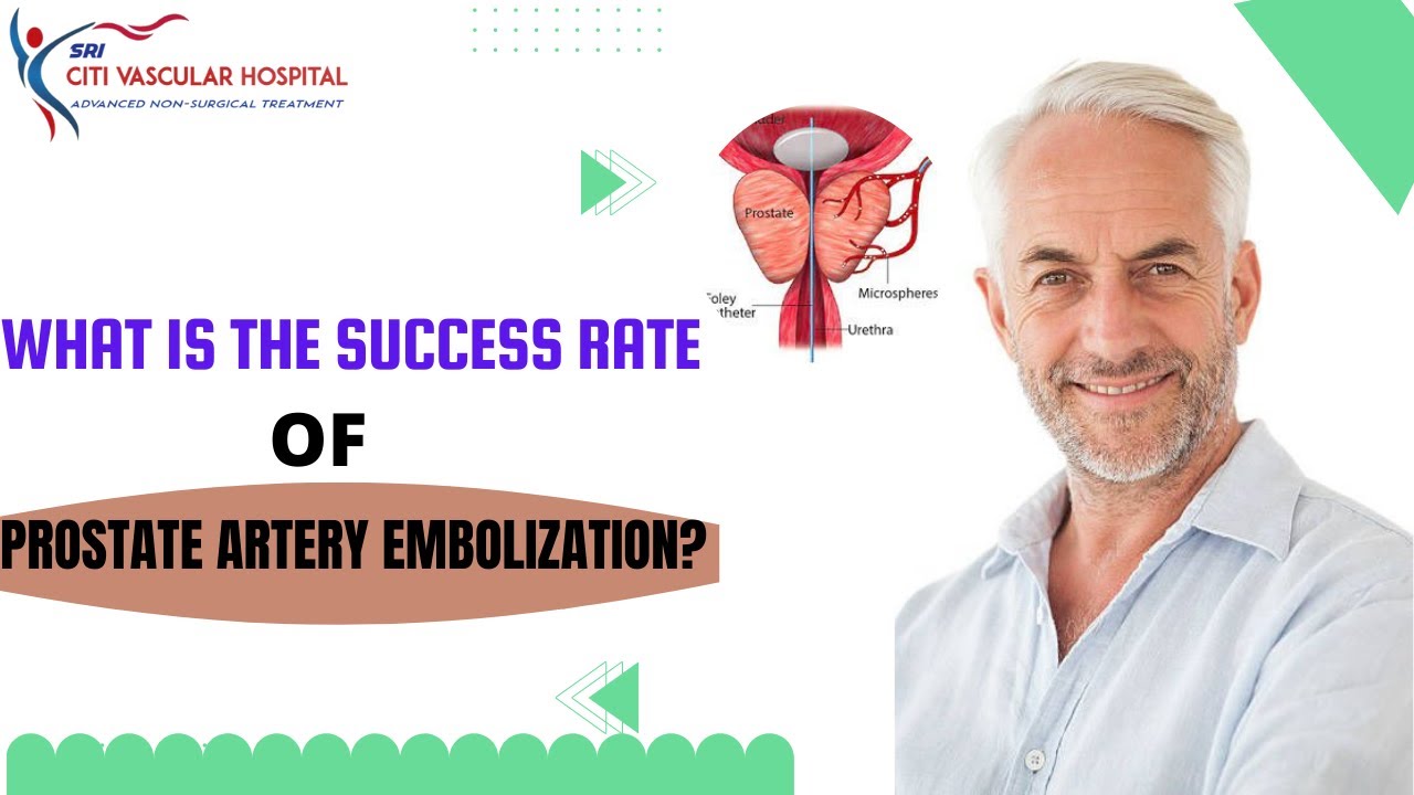 Prostate Artery Embolization Success vs common TURP prostate surgery ...