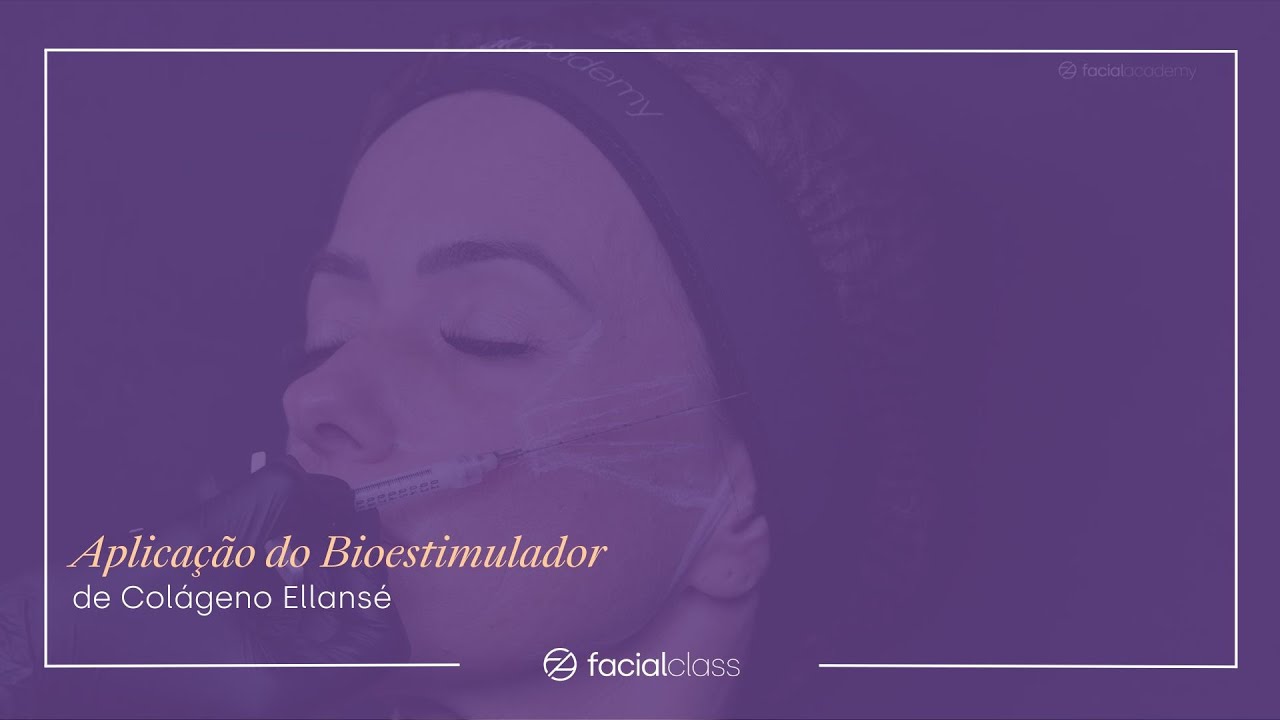 Aplicação do Bioestimulador de Colágeno Ellansé | Facial Class - YouTube