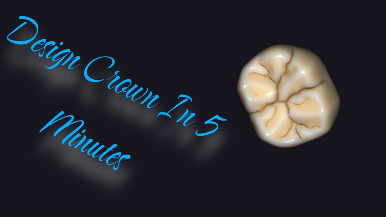 How to design a single crown in Exocad in 5 minutes ? - YouTube