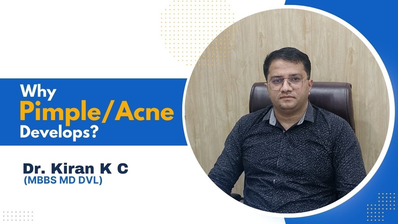 Why Pimple/Acne Develops ? - YouTube