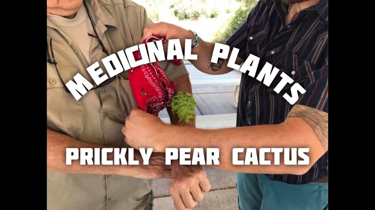 Treating Sunburns In the Field (Prickly Pear Cactus) - YouTube