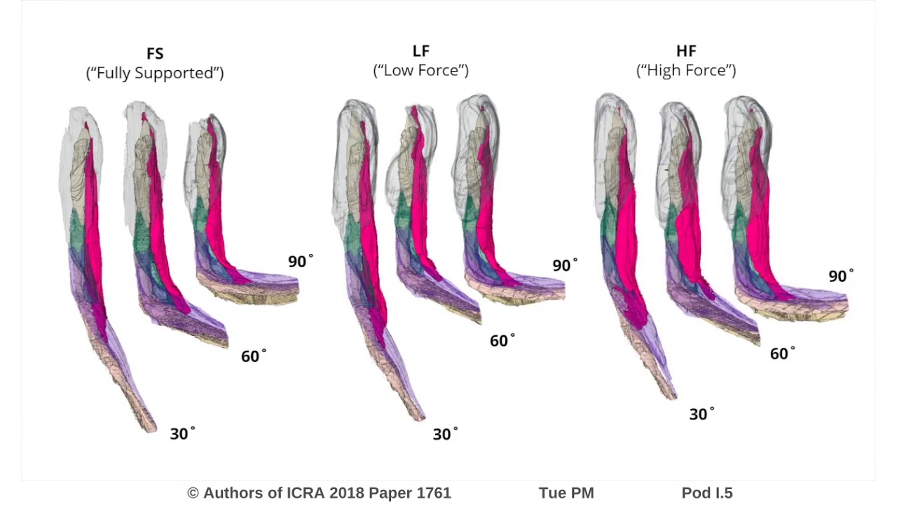 Empirical Quantification and Modeling of Muscle Deformation: Toward ...