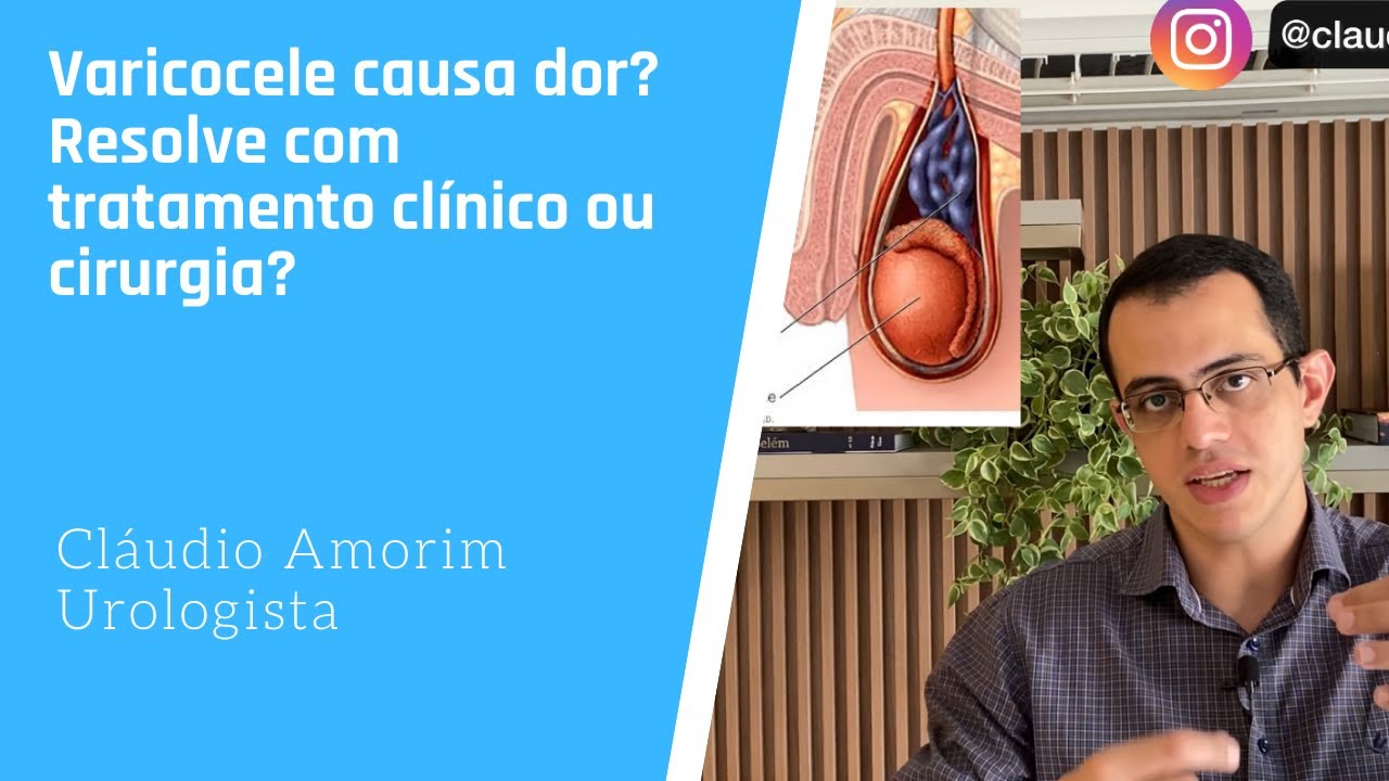 Varicocele causa do no testículo? Precisa de tratamento clínico ou ...
