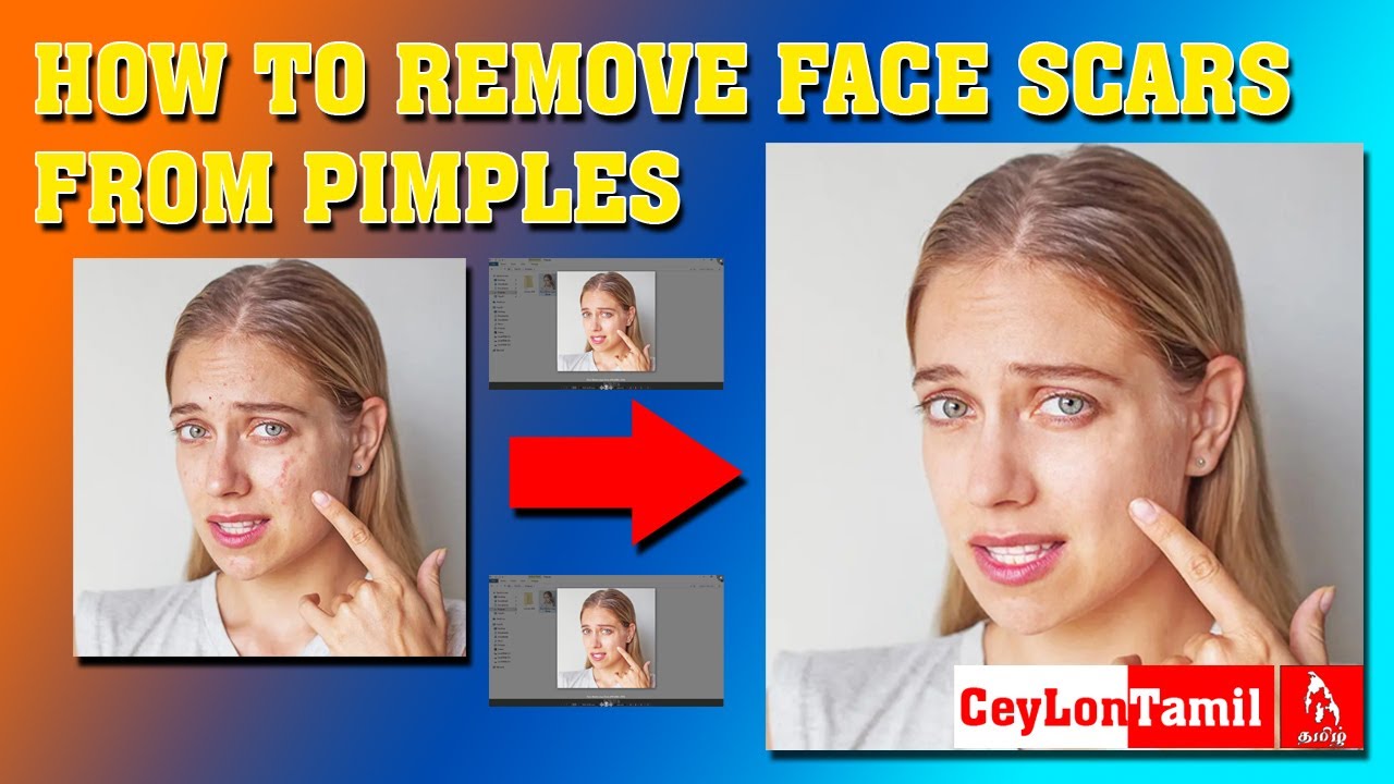 HOW TO REMOVE FACE SCARS FROM PIMPLES | FACE RETOUCHING | 2021 | ADOBE ...