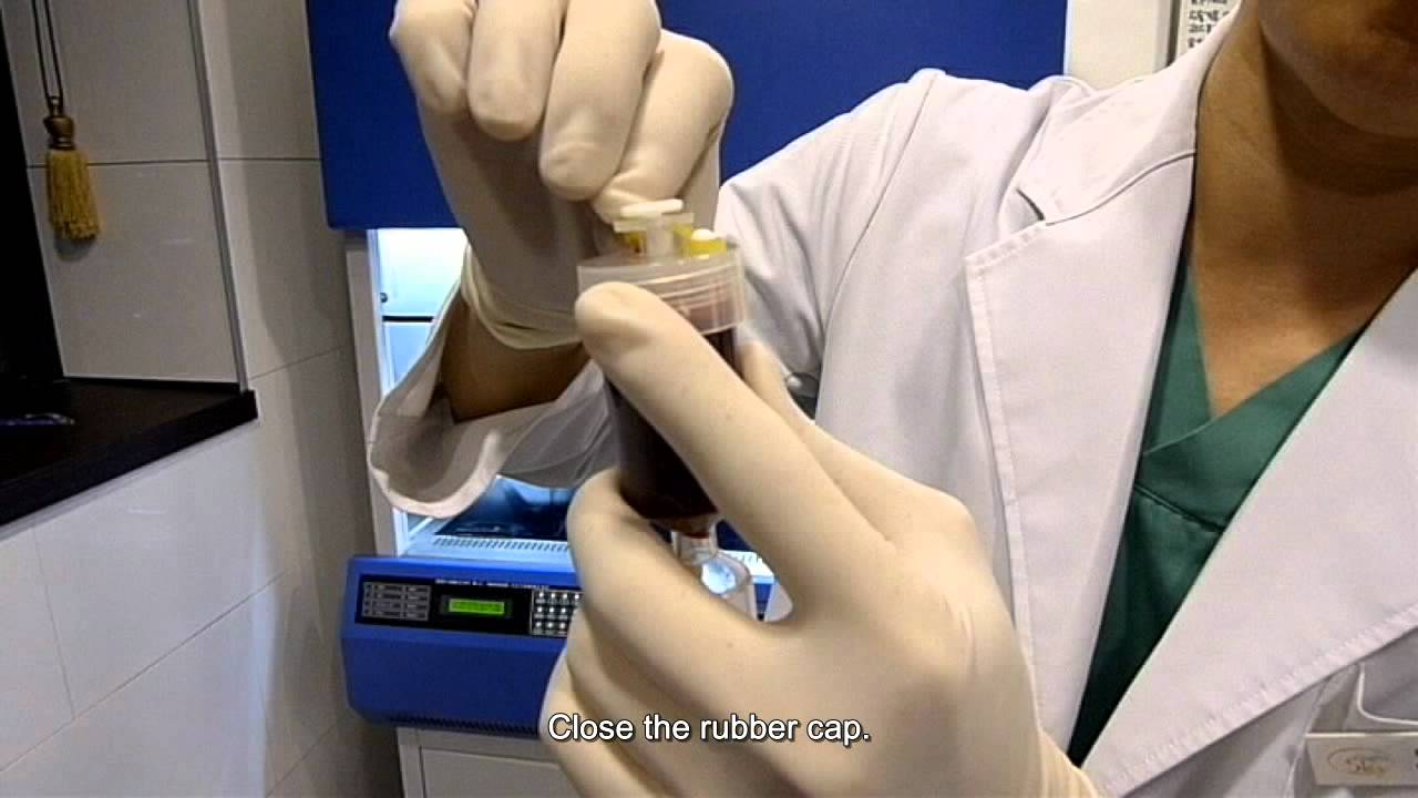 (HD) PURE PRP, Platelet Rich Plasma, Isolation Video - from PNC INT ...