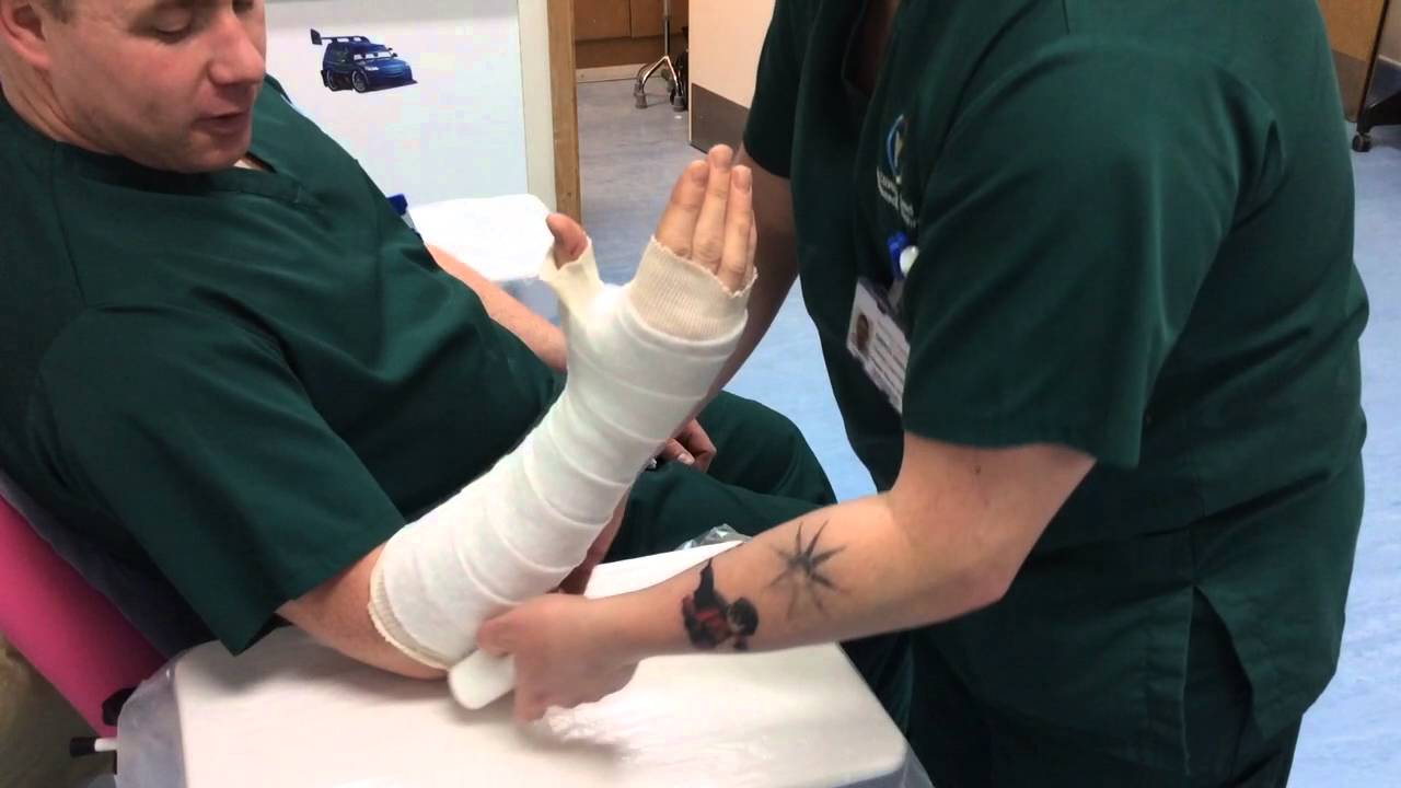 Below elbow cast using DCC - YouTube