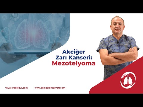 HAVADAKİ TEHLİKE: ASBEST VE NEDEN OLDUĞU AKCİĞER ZARI KANSERİ MEZOTELYOMA