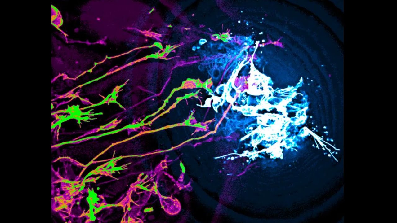 "Neuronal guidance" by Alexandre Dumoulin (University of Zurich) - YouTube