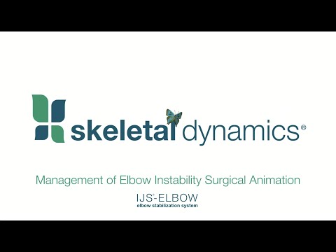 IJS® Elbow Stabilization System Animation - YouTube