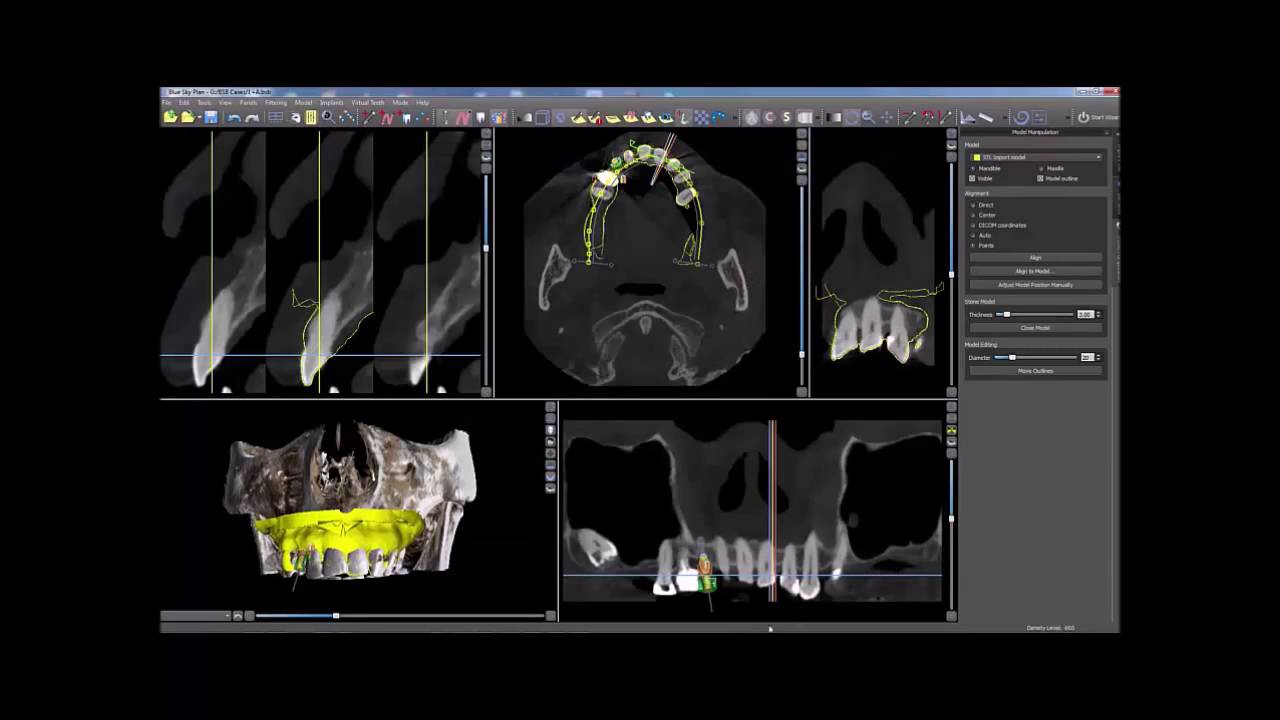 BSP Step by Step Tutorial - Importing a Second Model - YouTube