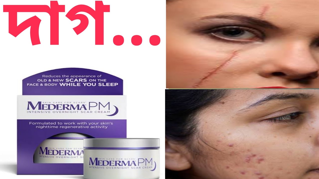 Mederma PM Intensive Overnight Scar Cream || Medrma Pm Night Cream ...