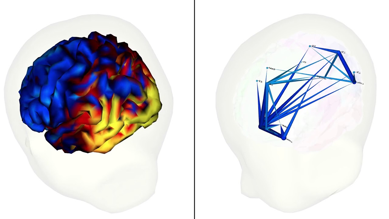 Real-time video of EEG corresponding functional network - YouTube