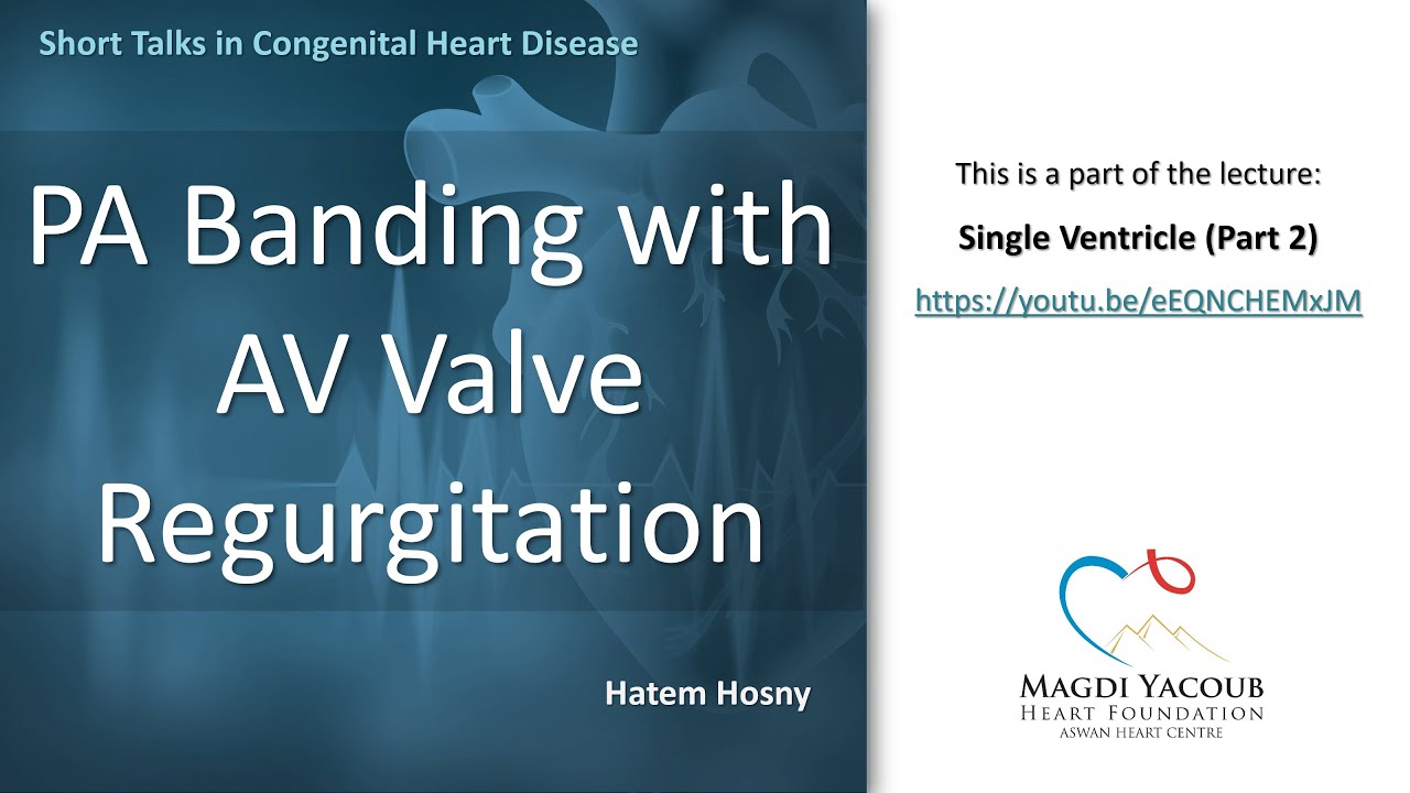 PA Banding with AV Valve Regurgitation - Hatem Hosny - YouTube