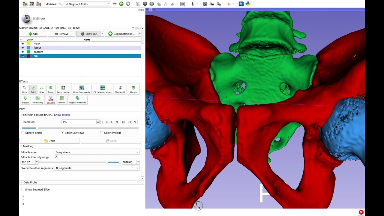 CT Scan to STL for Importing into FeBio Studio using 3DSlicer - YouTube