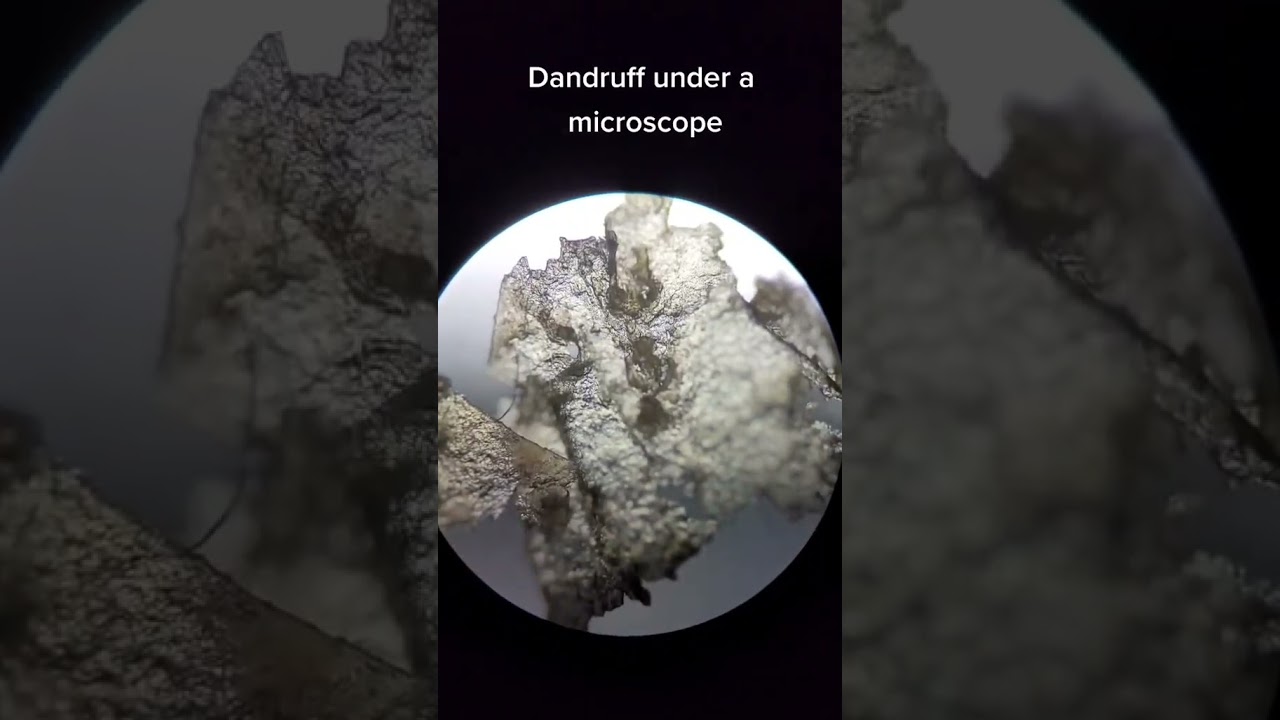 Dandruff Microscope
