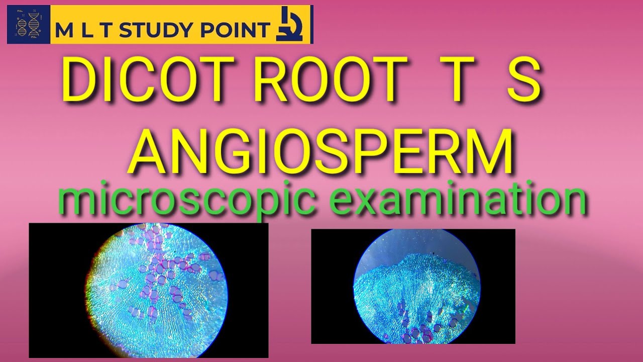 dicot root t.s angiosperm microscopic examination| science and biology ...