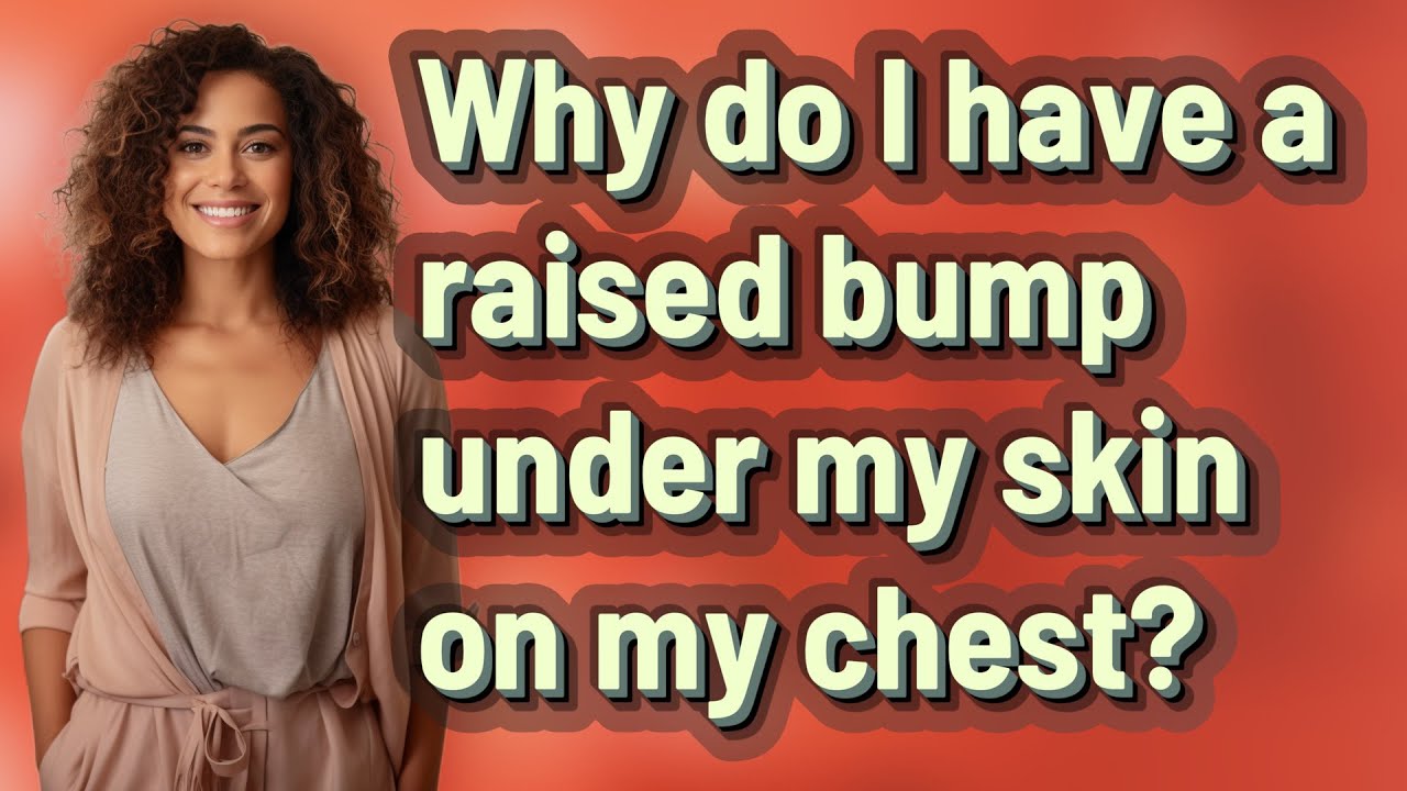 Why do I have a raised bump under my skin on my chest? - YouTube