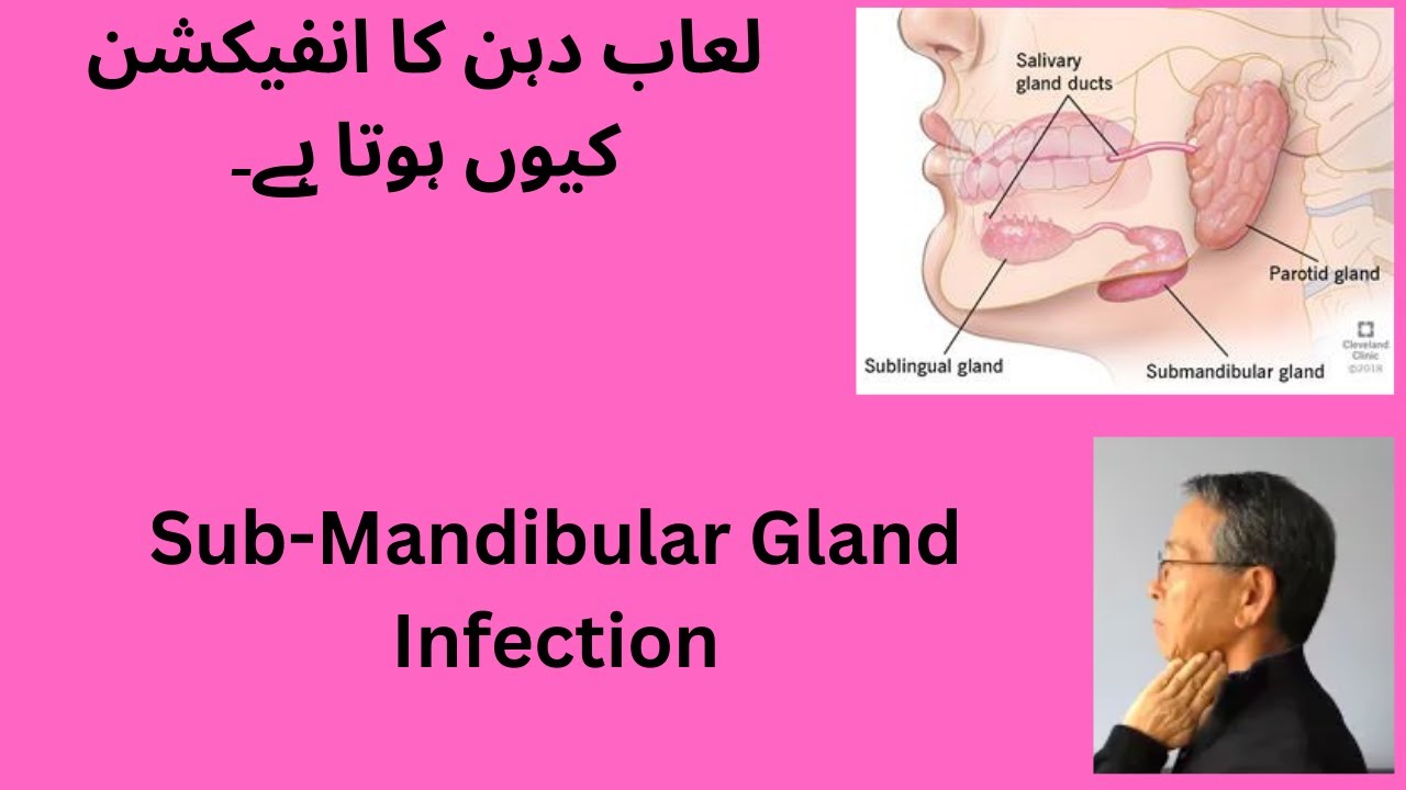 Salivary Gland Infection/Sub-Mandibular gland Swelling. - YouTube