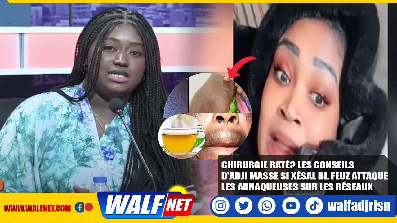 Chirurgie Ratée ? les conseils d'Adji Mass si xésal bi, Feuz attaque ...