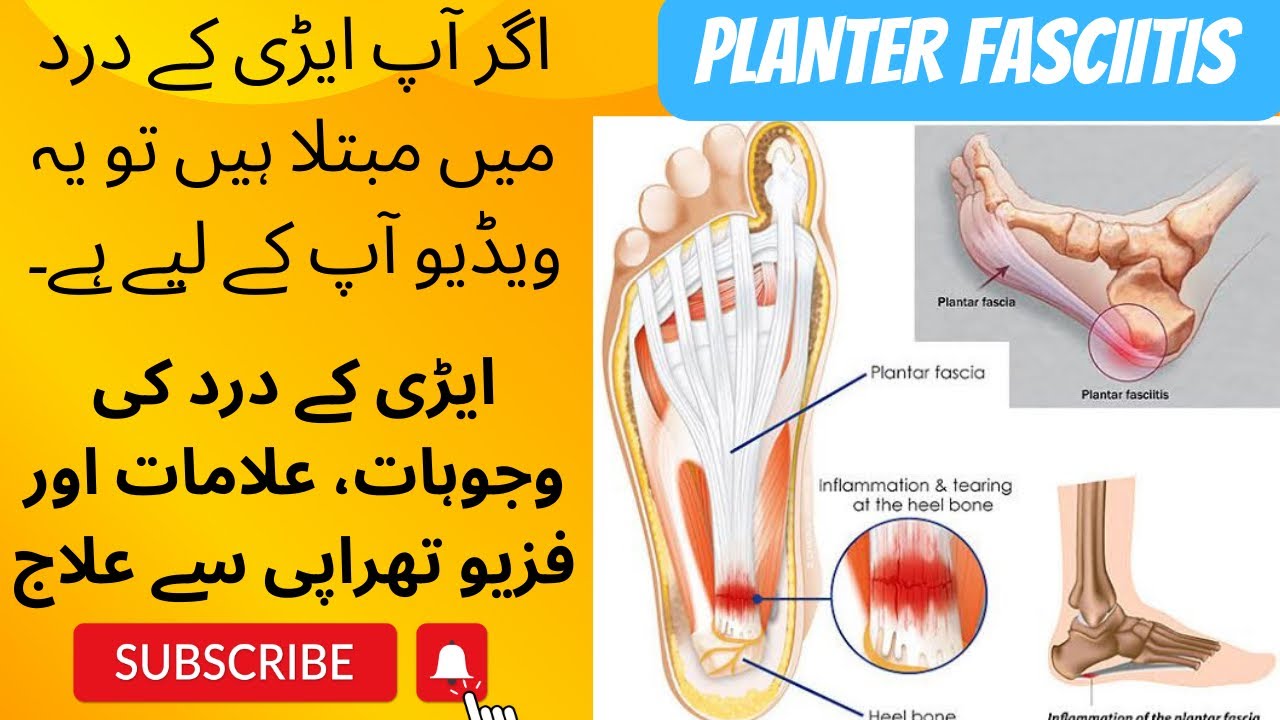 Heel Pain | Planter Fasciitis | Causes | Symptoms | Physiotherapy ...