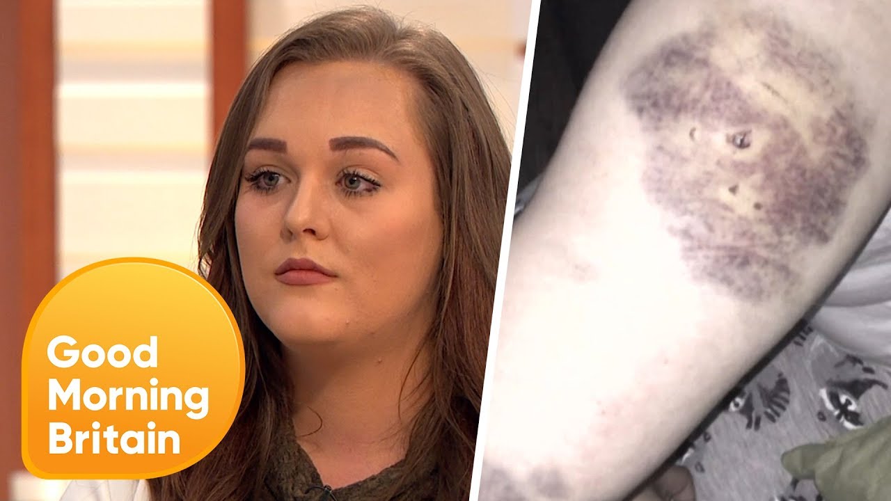 Domestic Abuse Victim Calls for Others to Speak Out | Good Morning ...