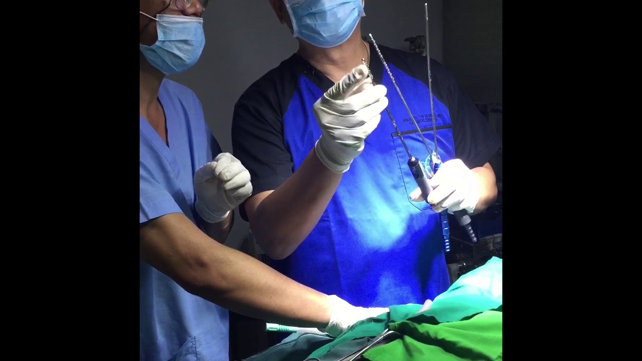 Underarm Sweating Surgical Procedure - YouTube