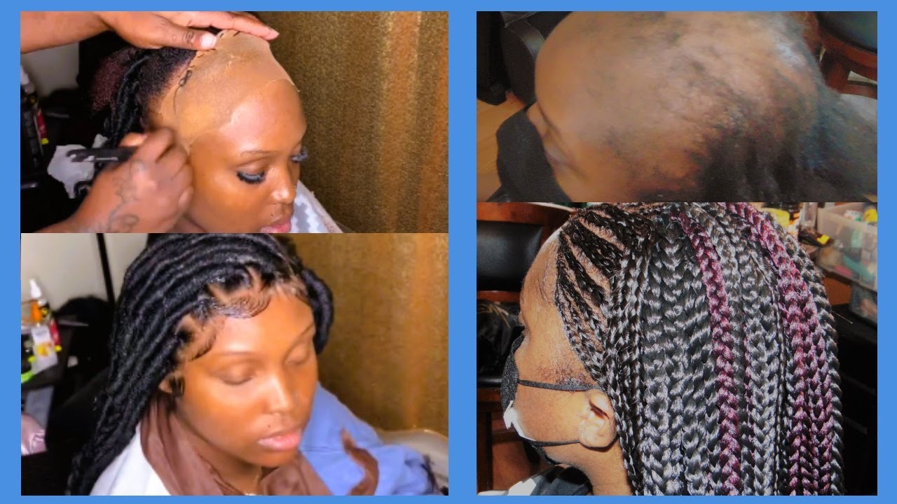 MOST POPULAR FRONTAL BRAID METHODS EVER SEEN ON YOUTUBE! - YouTube