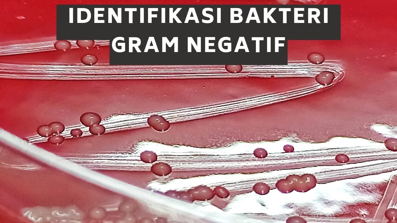 Identifikasi Bakteri Gram Negatif - YouTube