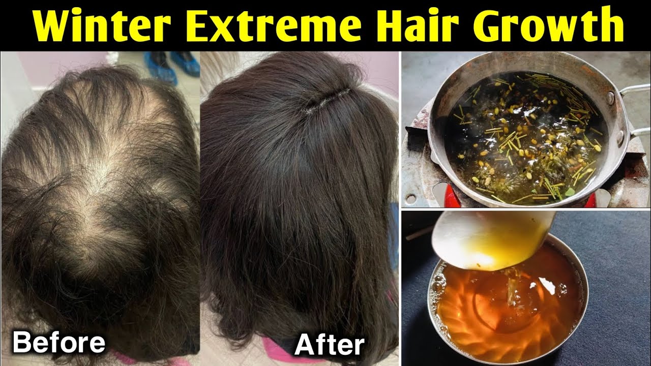 Winter Extreme Hair Growth Serum for Fast Regrowth Hair 😊 | How to Grow ...