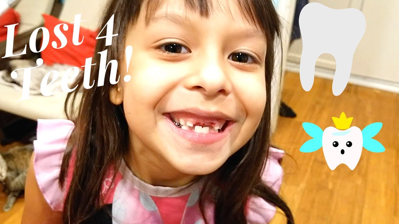 I lost My First Tooth!! | 6 Year Old Loosing 4 Teeth - YouTube