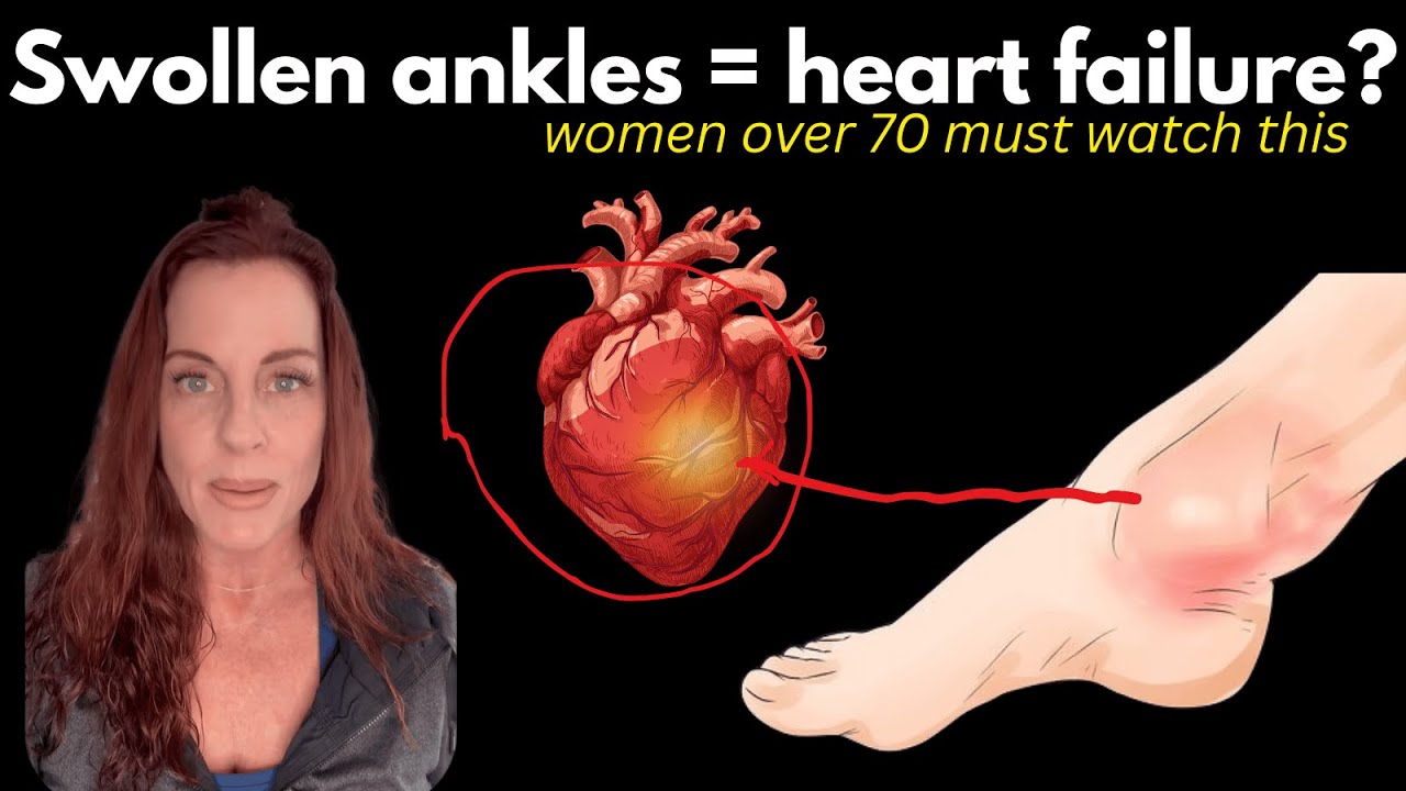 Swollen ankles in older women — heart failure or just poor circulation ...