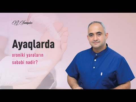 Ayaqlarda xroniki yaraların səbəbi nədir?