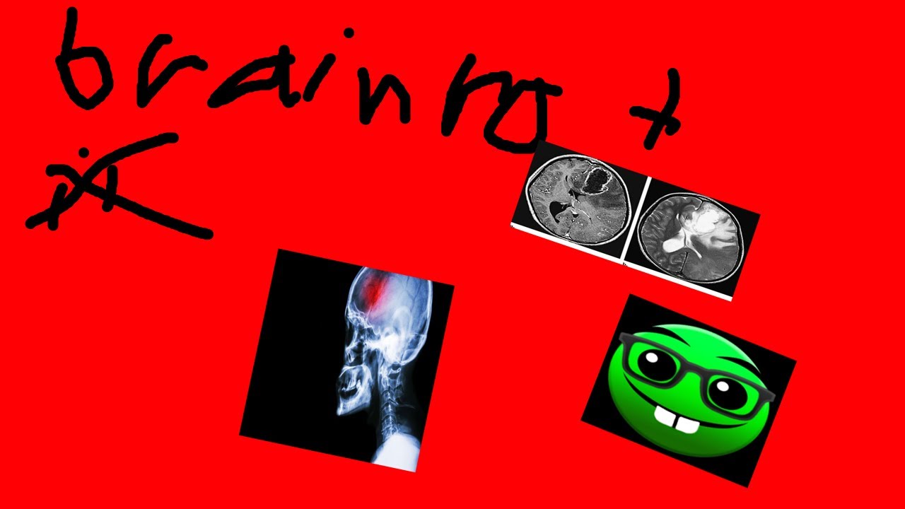 brain rot edit - YouTube