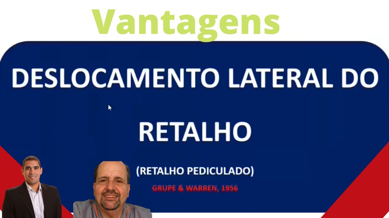 Deslocamento Lateral do Retalho: Vantagens e Benefícios @dr.alexguedes ...