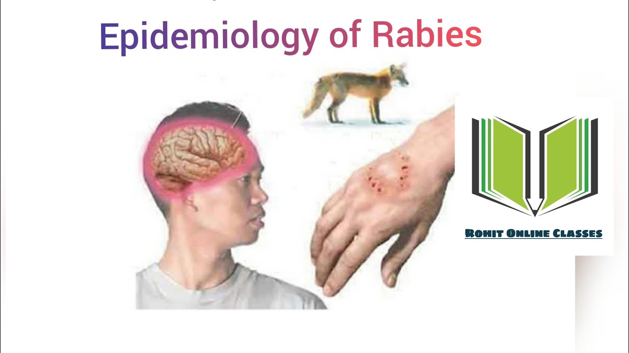 Epidemiology of Rabies Disease - YouTube