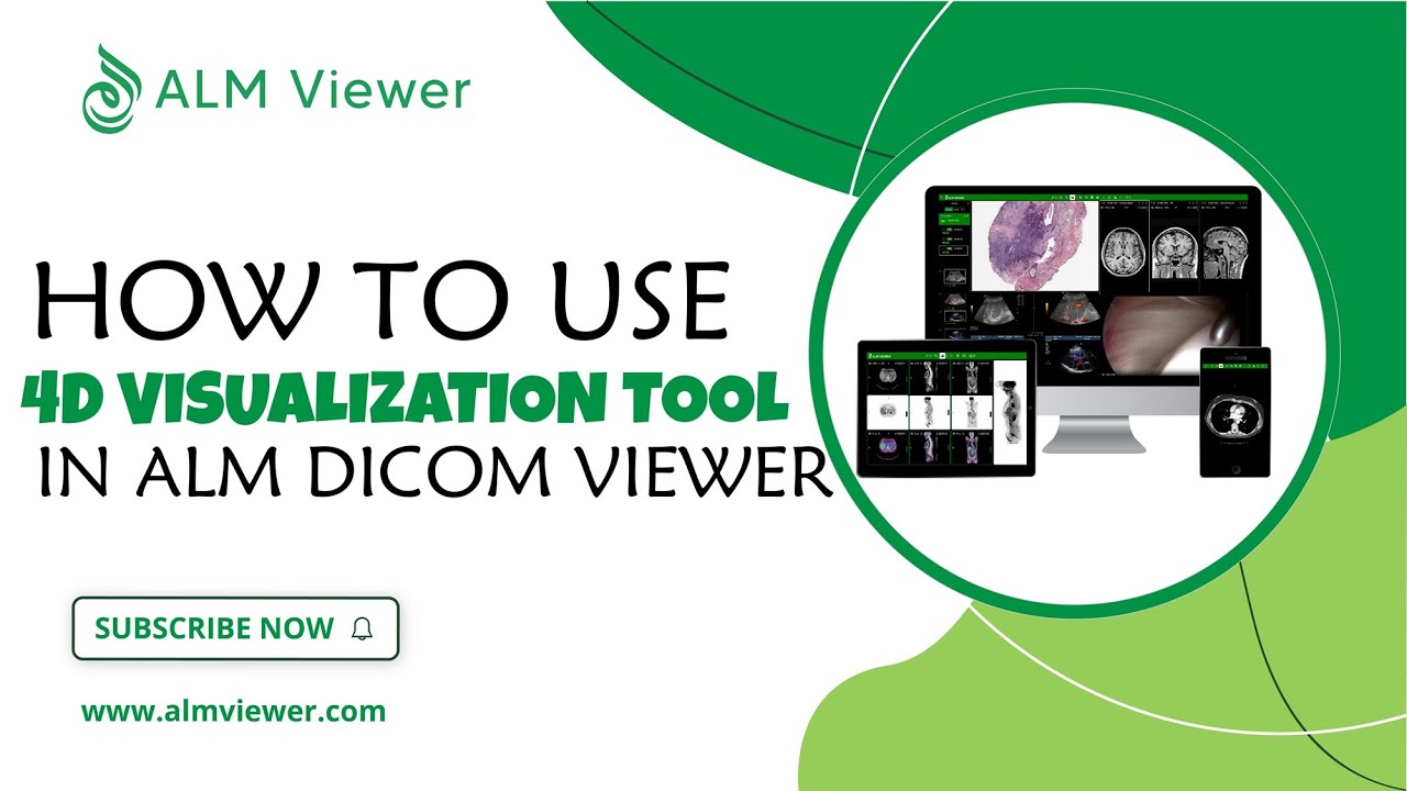 How to Use 4D Visualization in ALM Dicom Viewer | By Alm Viewer - YouTube