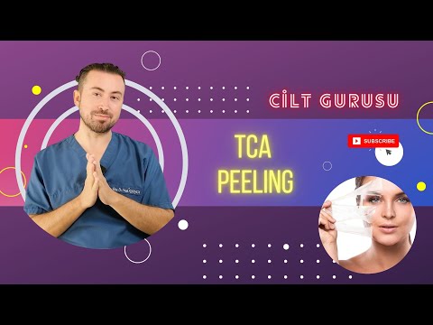 TCA Peeling ile Cilt Yenileme Hakkında Merak Edilenler