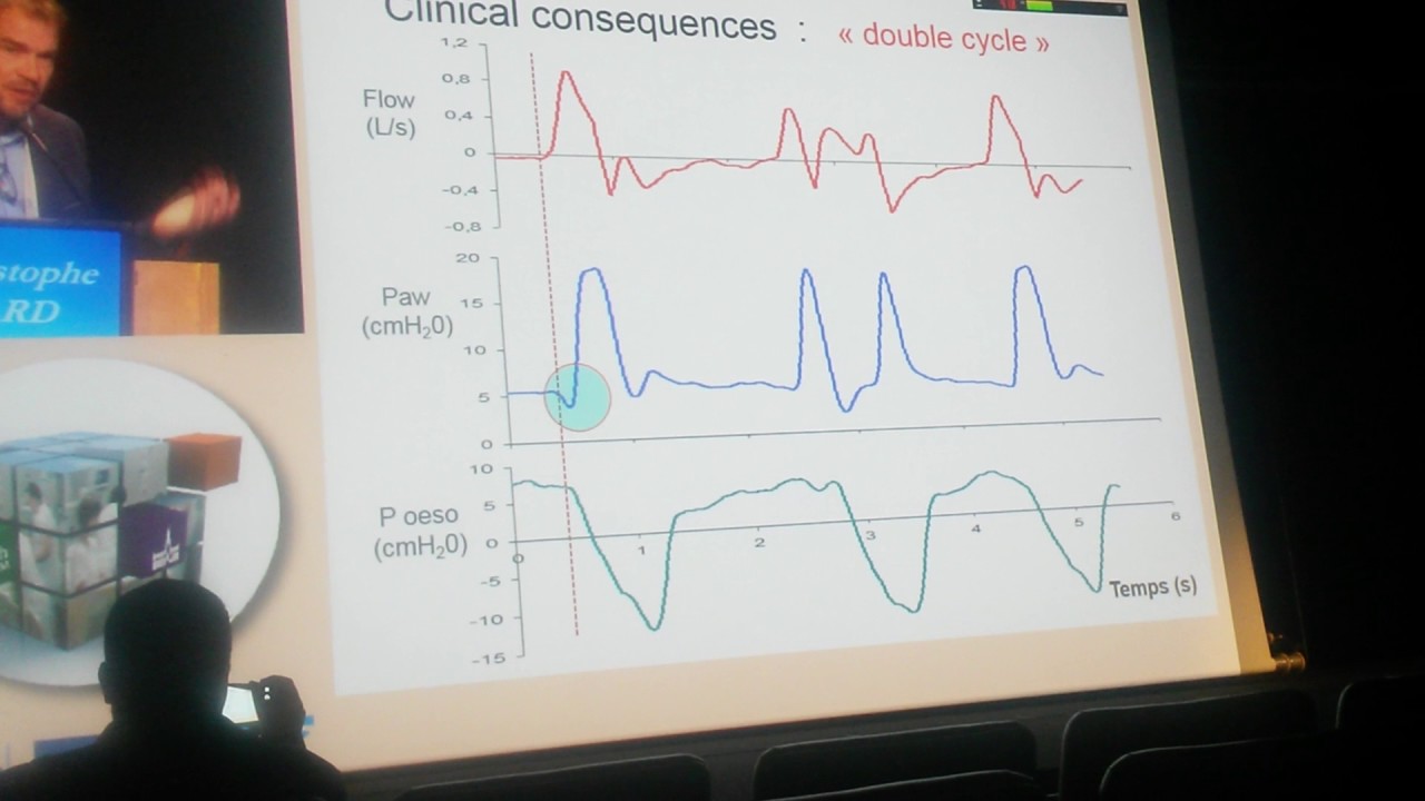 Reverse triggering a new type of asynchrony - YouTube