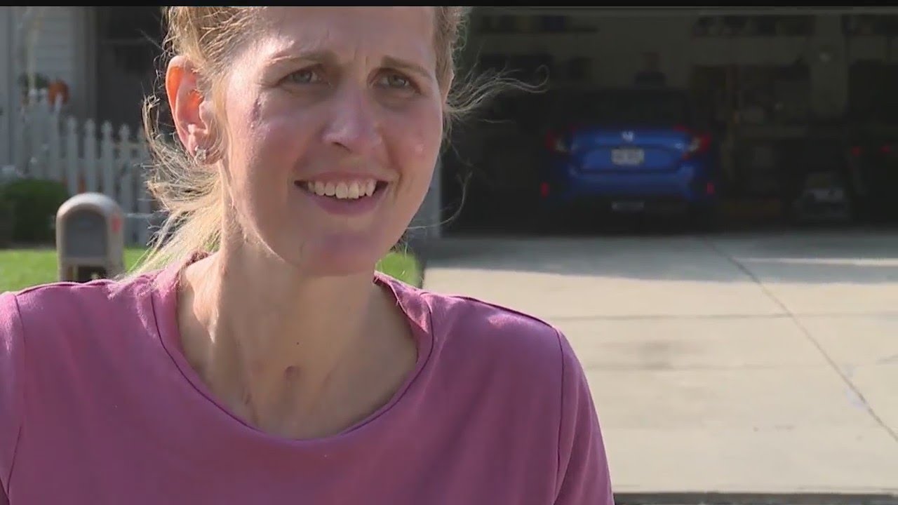 Poland's Kristin Fox honored by former Pittsburgh Steeler; lead doctor ...