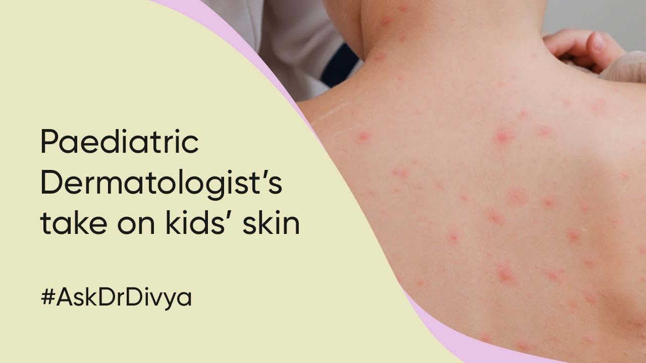 Pediatric dermatologists' take on kids skin do's and don'ts - YouTube
