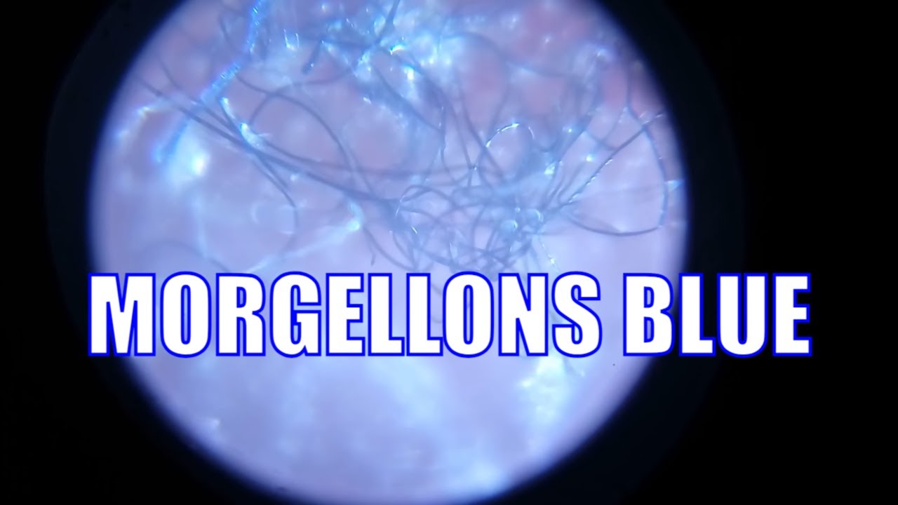 Blue Morgellons Fibers Microscopy 200x - 240x - YouTube