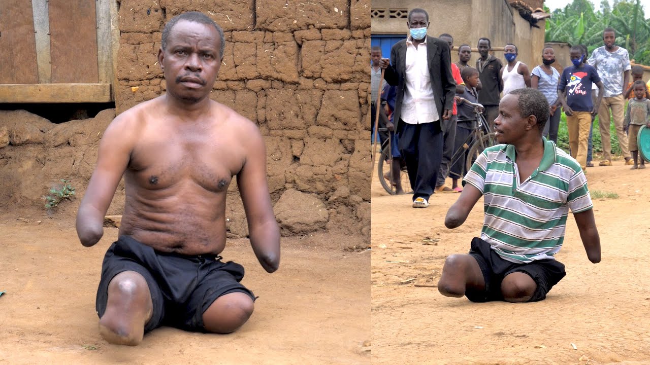 Life Without Limbs: The Father Of Seven With No Hands Or Legs ...