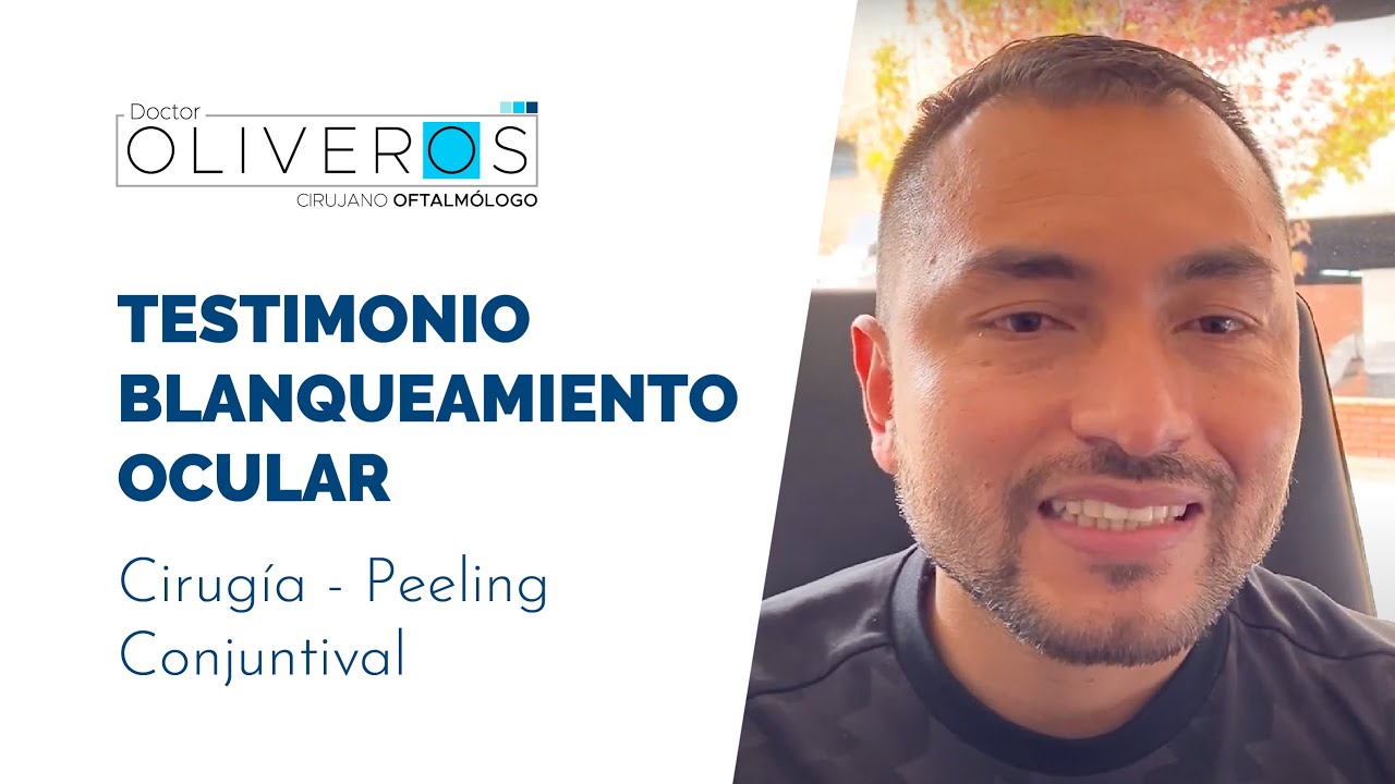 👁️‍🗨️ Testimonio Blanqueamiento Ocular - Peeling Conjuntival - Dr ...