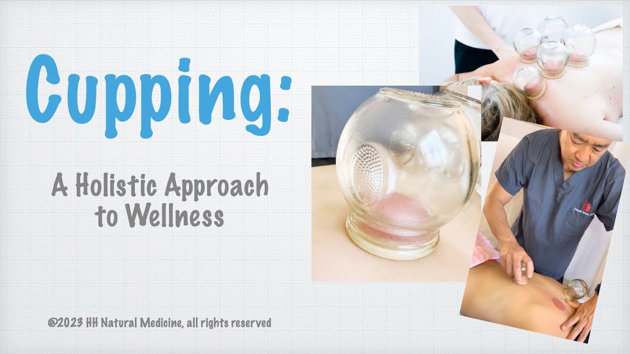 Cupping: a holistic approach to wellness - YouTube