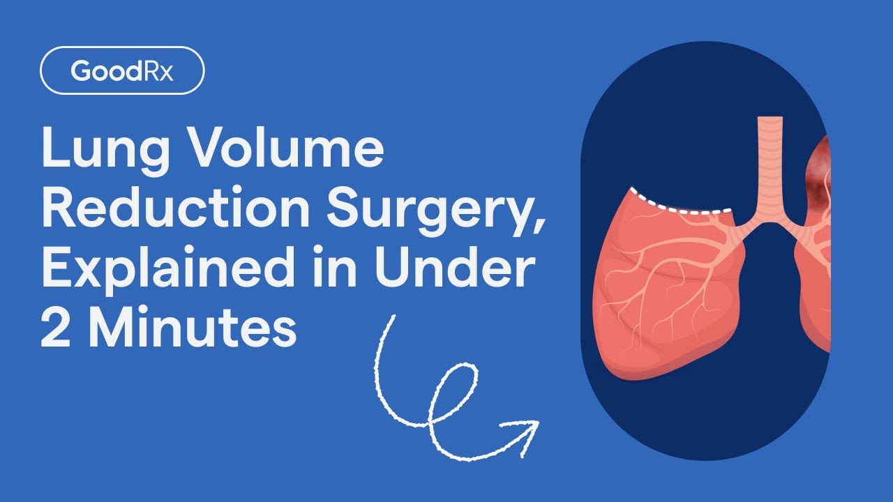 What Is Lung Volume Reduction Surgery and How Does It Work? | GoodRx ...