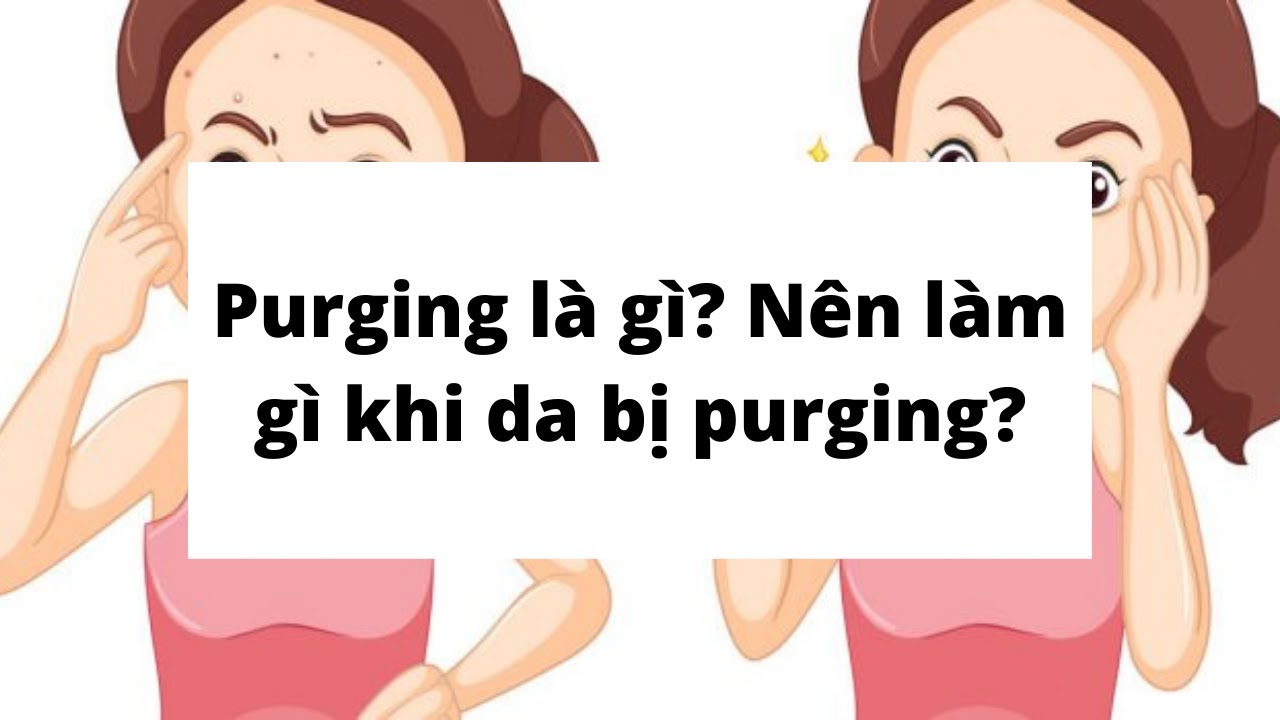 Purging là gì? Nên làm gì khi da bị purging? - YouTube