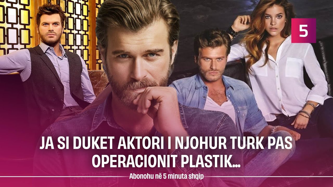 Ja si duket aktori i njohur turk pas ''operacionit plastik' - YouTube